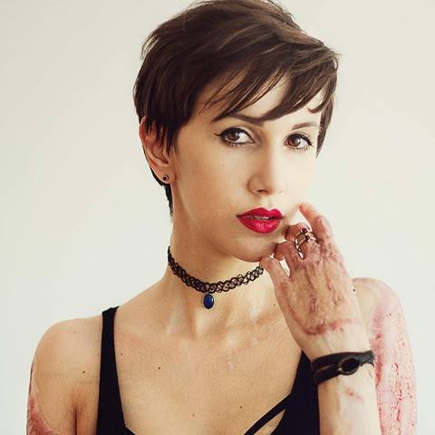 COLECTIV, 3 ANI. Alexandra Furnea: „Asistenta medicală îmi cânta doine ...